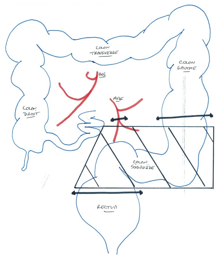 Colectomies - chirurgie du colon - Bordeaux Chirurgie Viscérale et ...