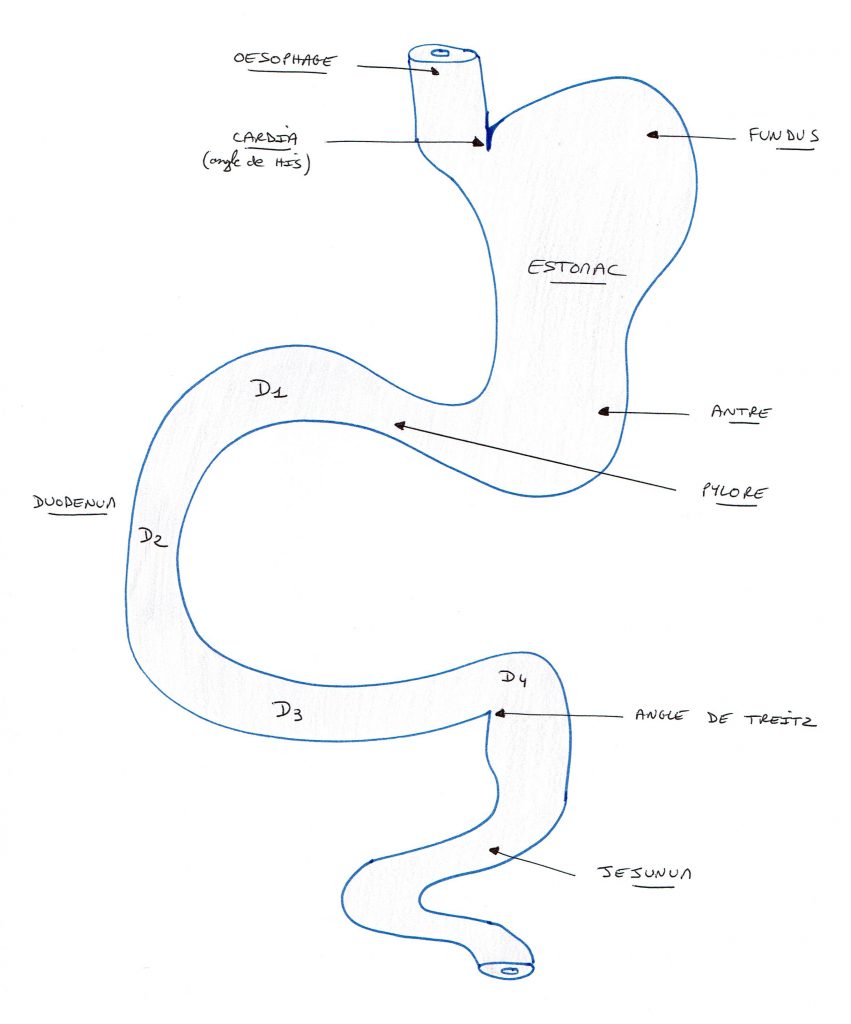 Gastrectomies - Bordeaux Chirurgie Viscérale et Digestive